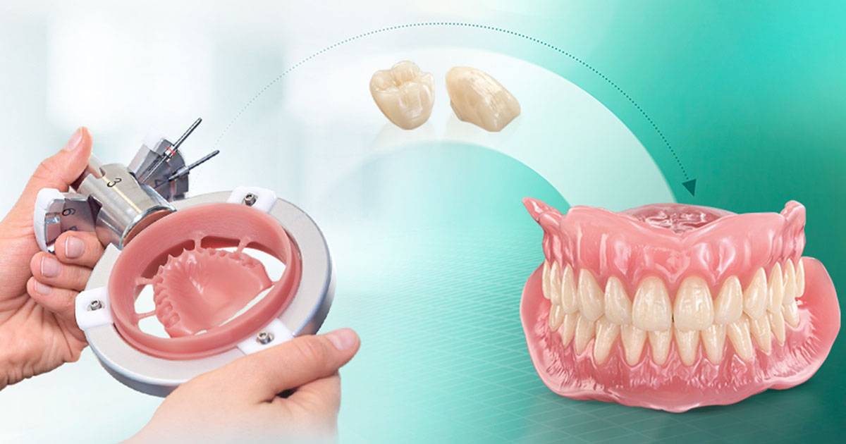 Everything You Need to Know About Digital Dentures - BaaBee
